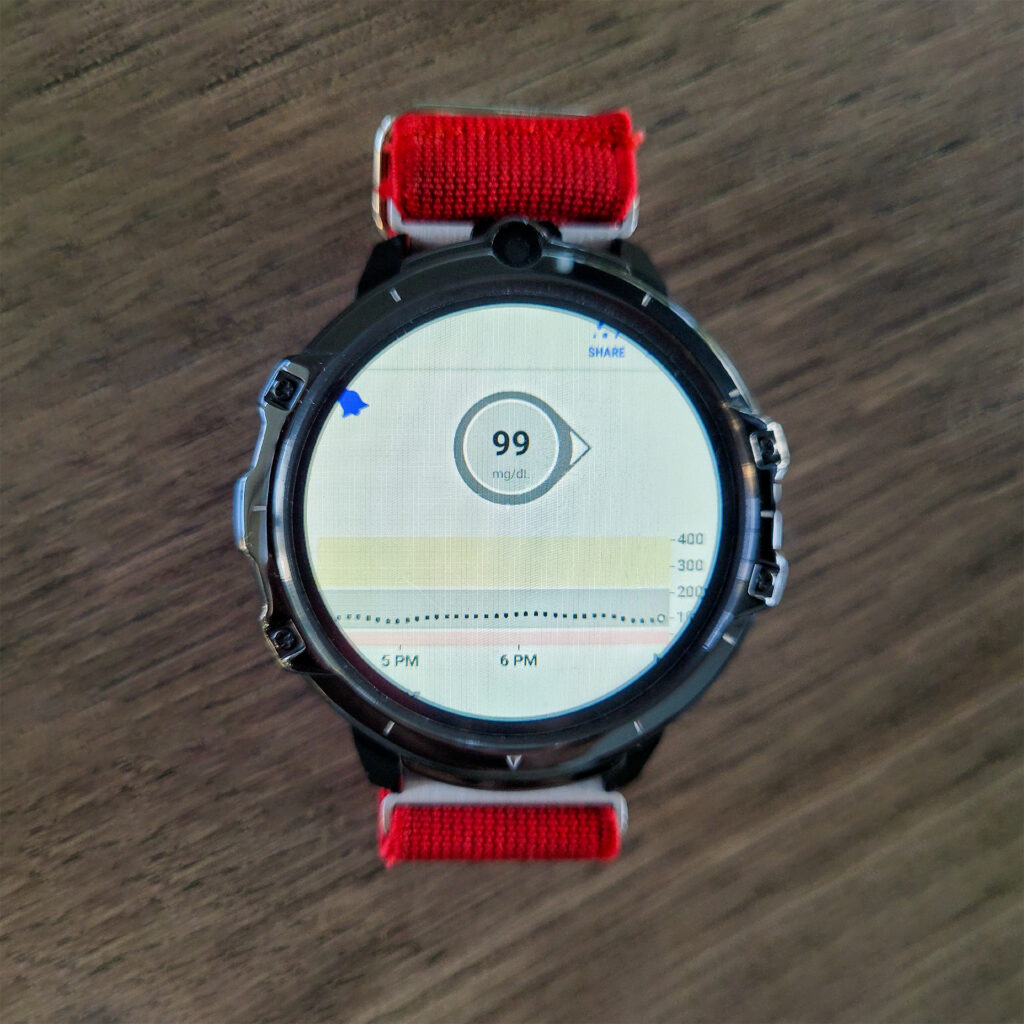 Monitoring CGM Readings Via a Watch - Gluroo