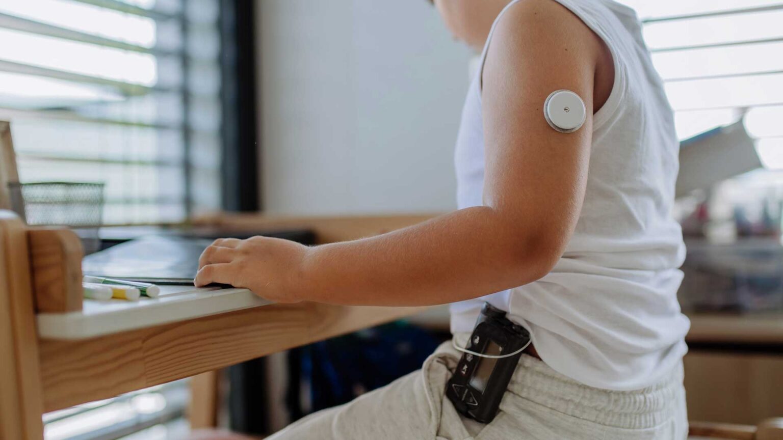 Which Insulin Pumps Are Closed-Loop? - Gluroo