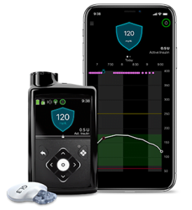 Which Insulin Pumps Are Closed-Loop? - Gluroo